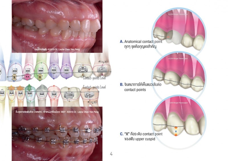 Orthidonticline - Ortho-news - handout